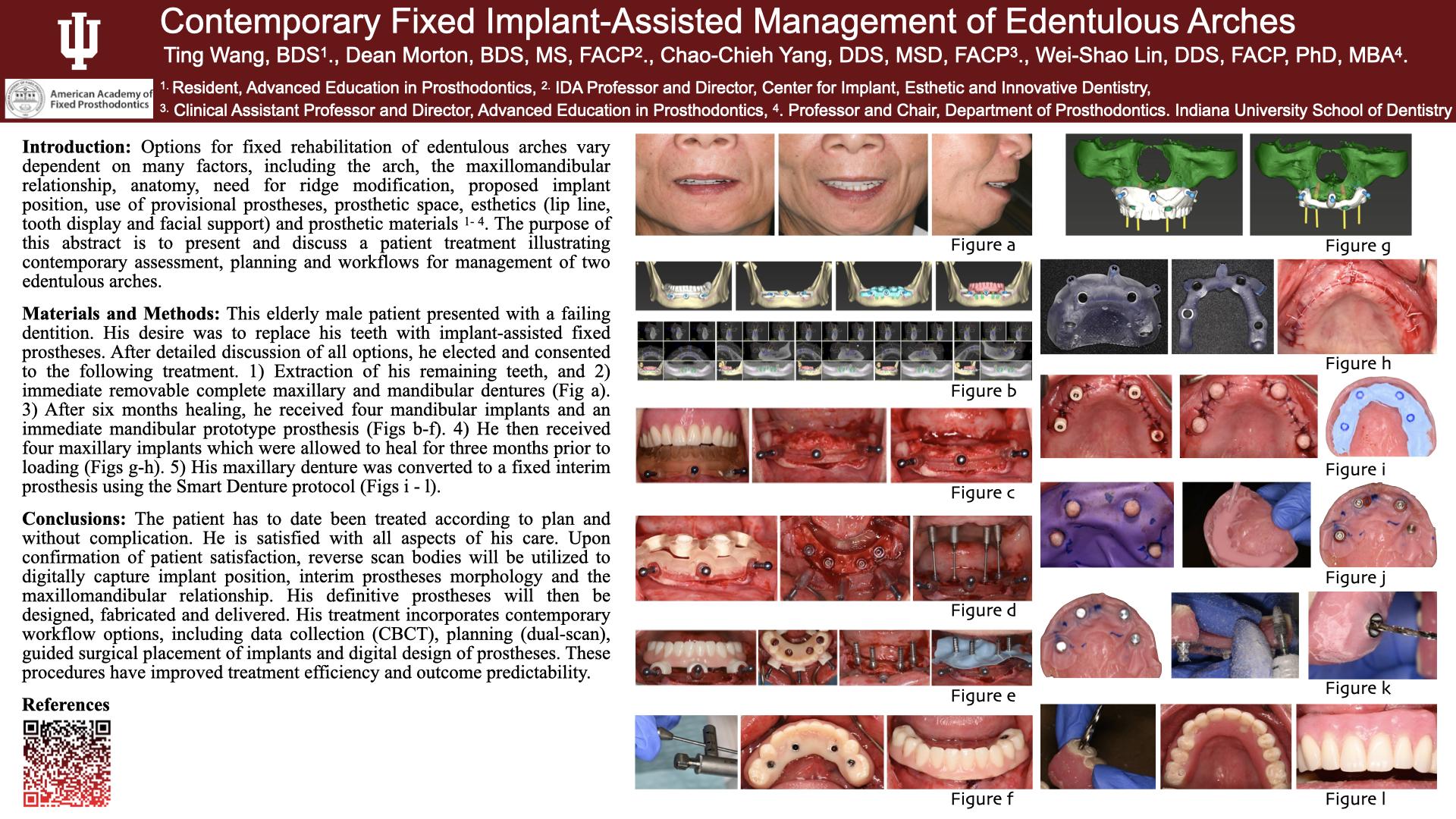 4. Contemporary Fixed Implant-Assisted Management of Edentulous Arches.