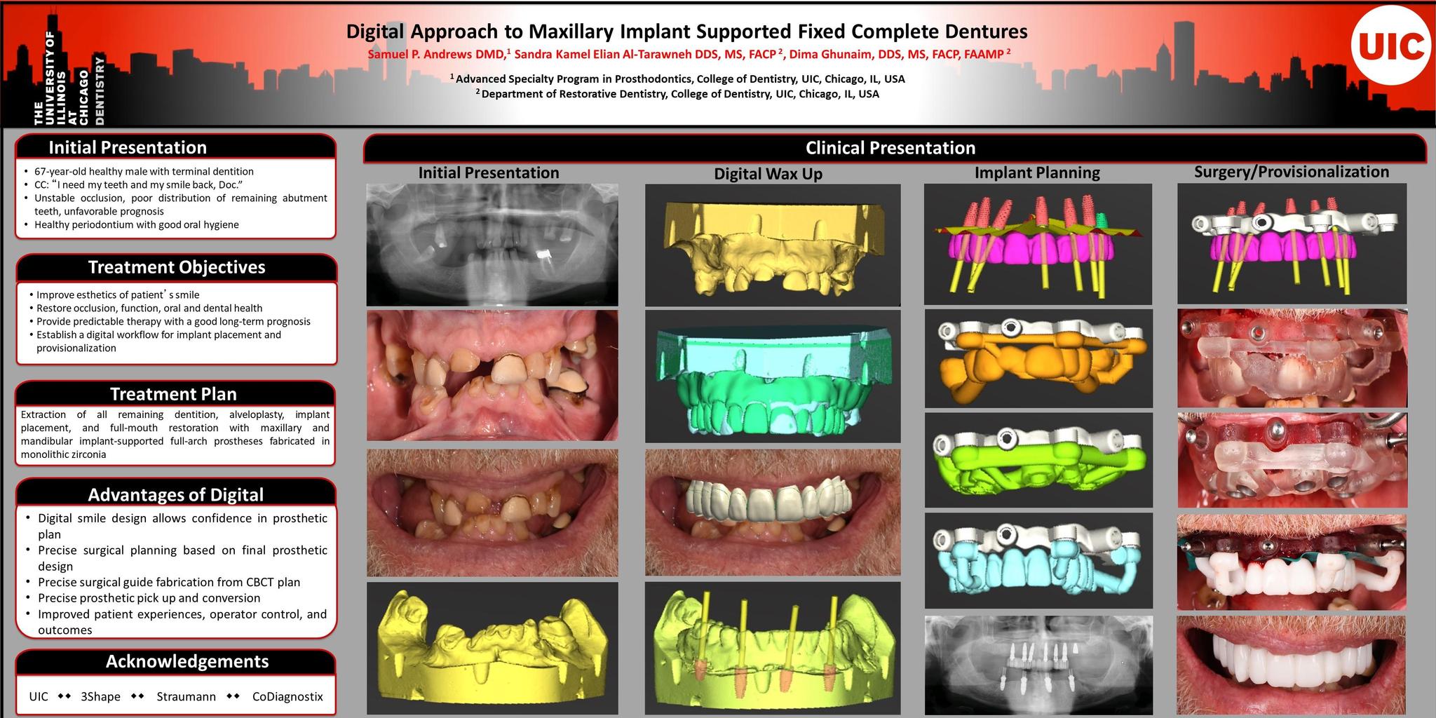 34. Digital Approach to Maxillary Implant Supported Fixed Complete Dentures