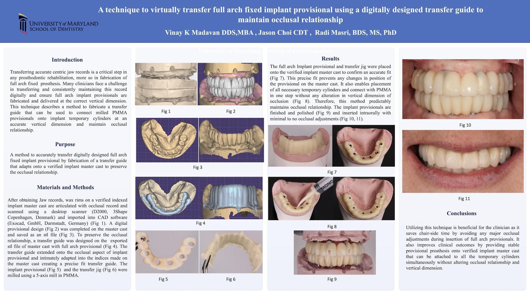 55. Digitally fabricated transfer guide preserves occlusal relationship ...