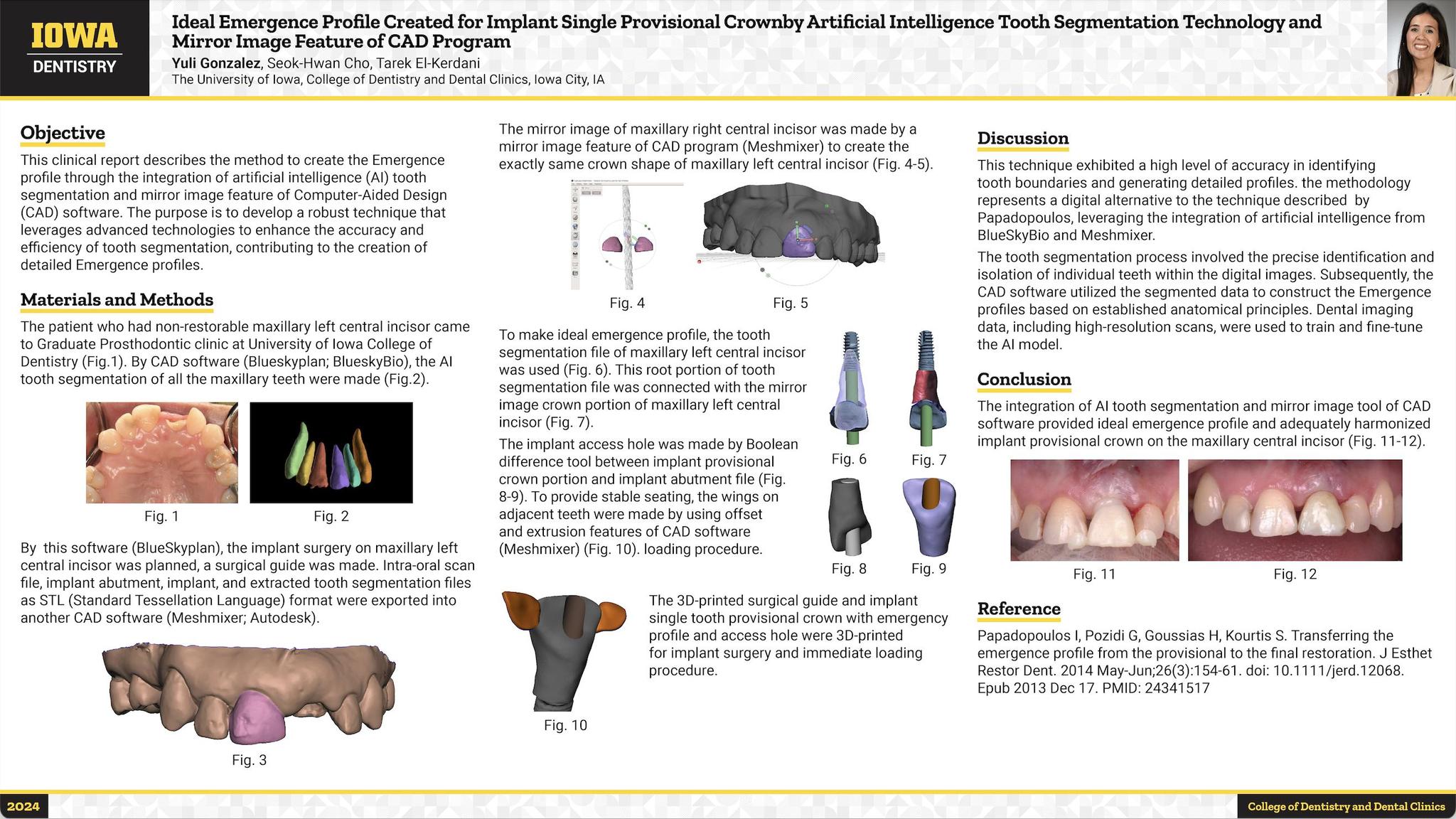 65. Emergence profile reproduction by artificial intelligence tooth segmentation and CAD software