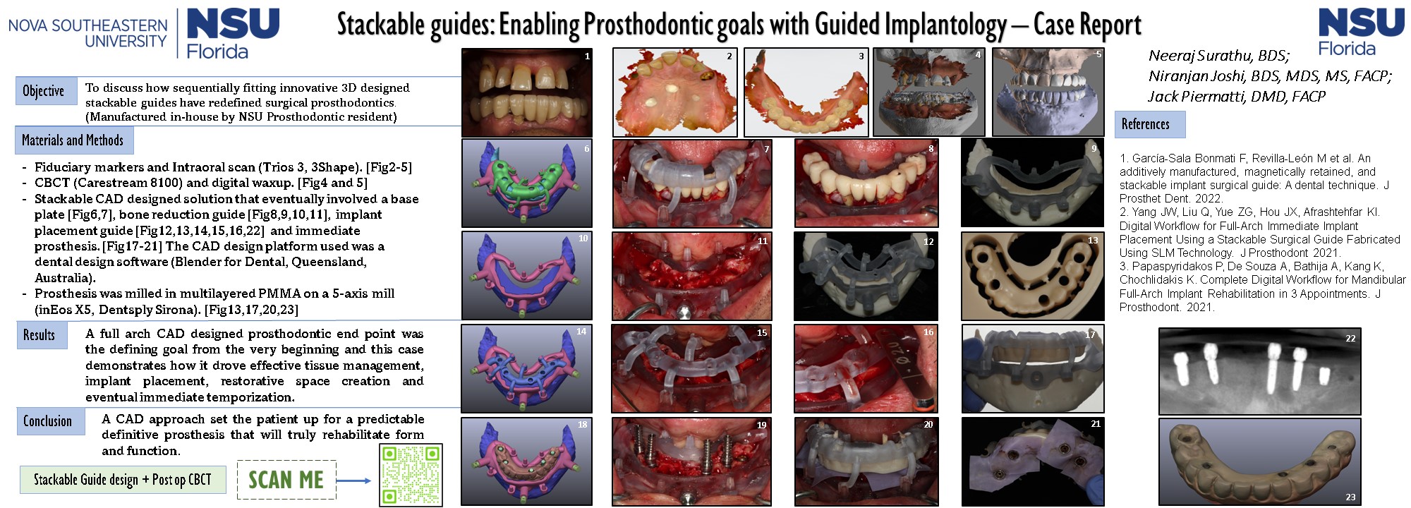 24. Stackable guides: Enabling Prosthodontic goals with Guided ...